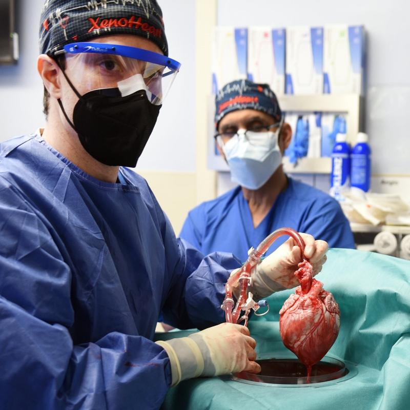 Organtransplantation 4.0 - Wann bekommen wir Herz, Niere und Leber von ...