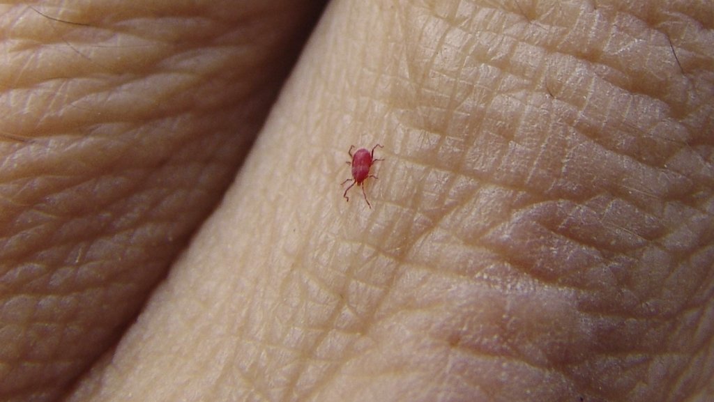 Grasmilben im Garten: Bisse erkennen und Juckreiz bekämpfen | BR24