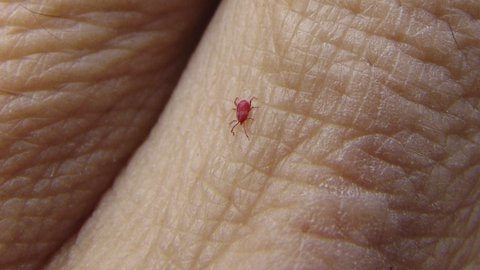 Grasmilben im Garten: Bisse erkennen und Juckreiz bekämpfen | BR24