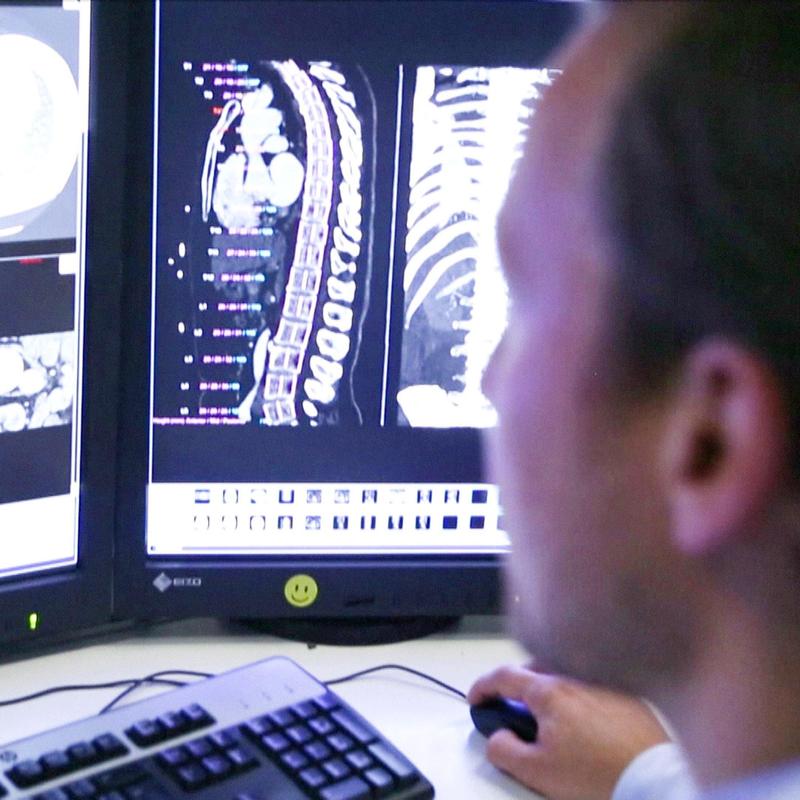 Nobelpreisträgertagung, Mähroboter und Igel, Quantenphysiker Immanuel ...