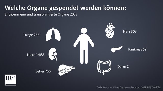 Neues Organspenderegister: Fragen und Antworten zur Organspende | BR24