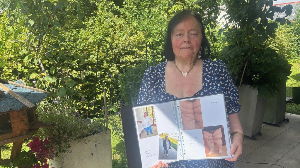 Große Freude bei Betroffenen: Lipödem-OP-Kosten werden bezahlt | BR24