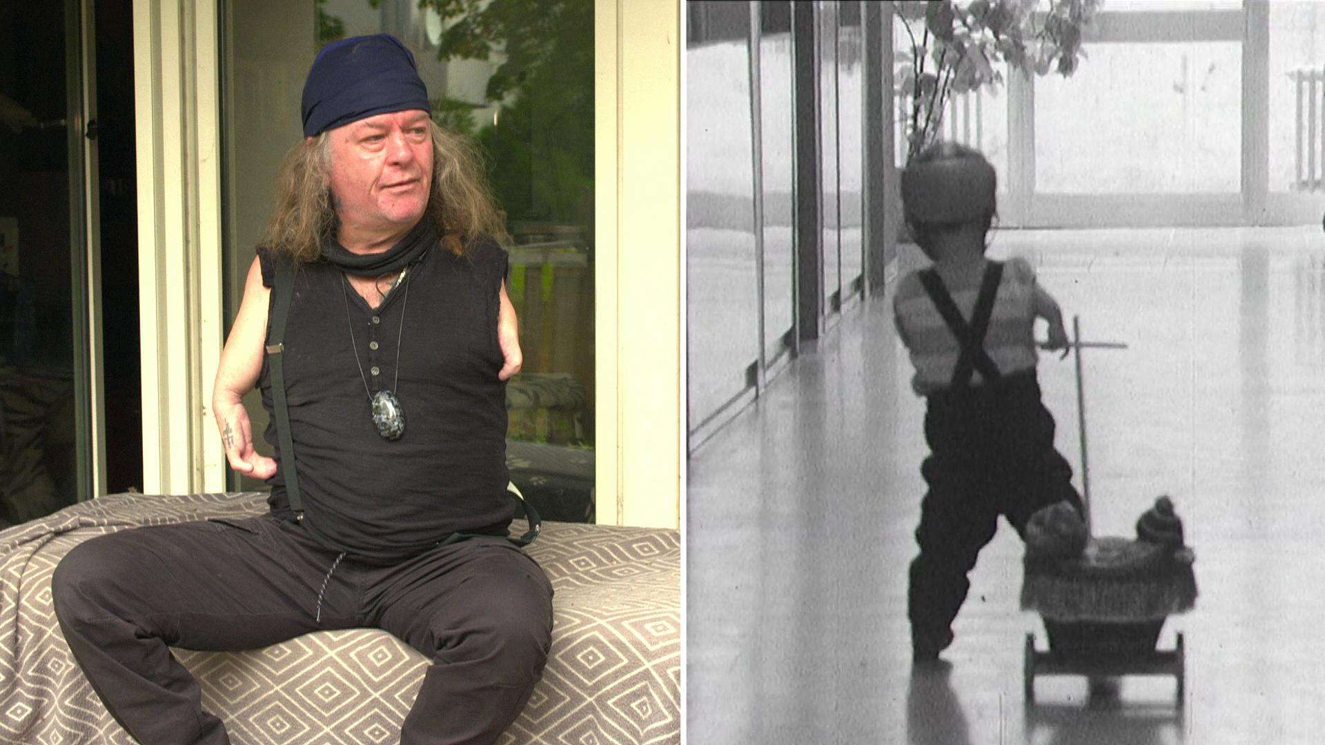 Contergan-Opfer: Der Kampf um Anerkennung | BR24